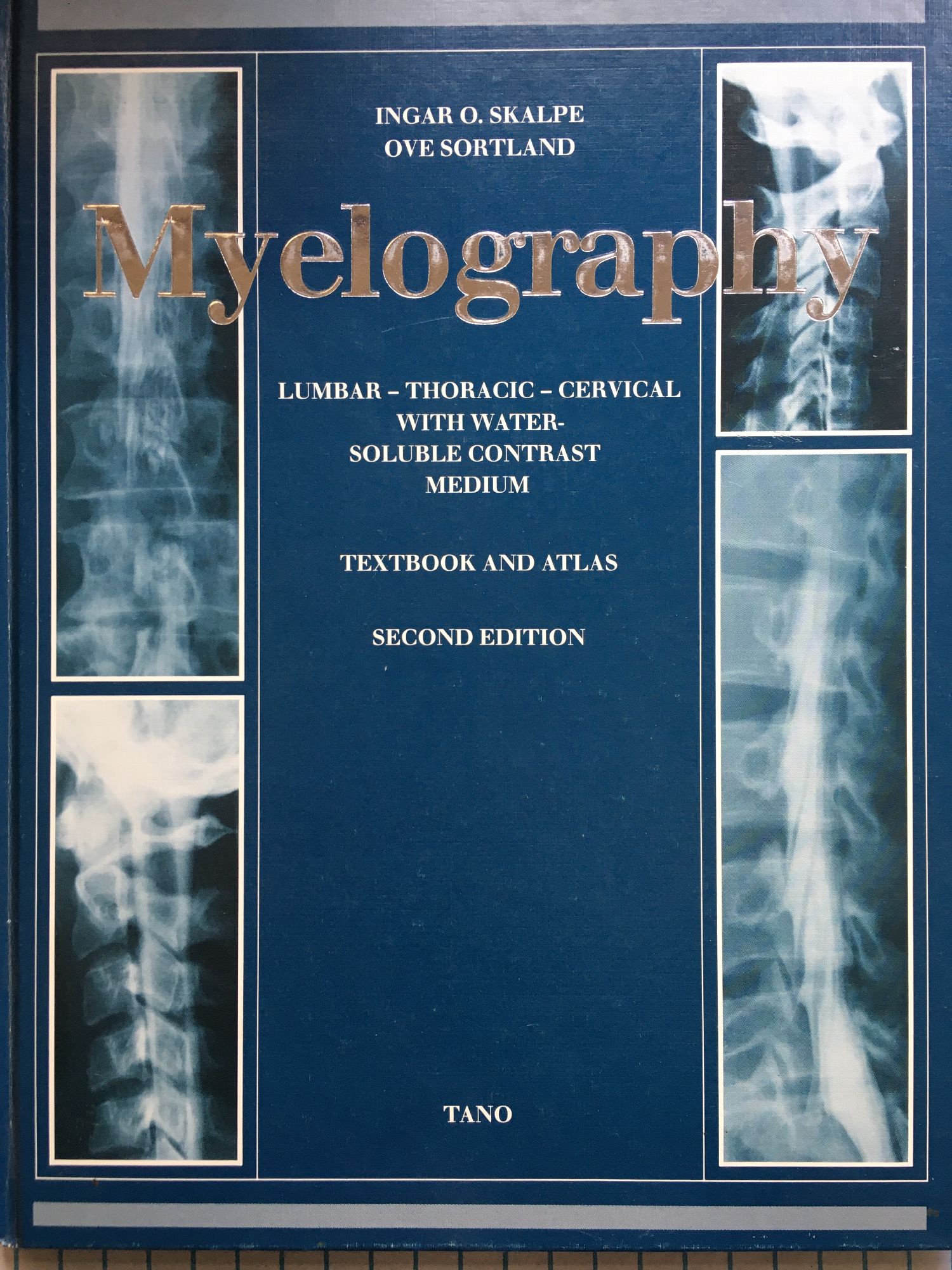 Myelography: Lumbar - Thoracic - Cervical With Water-Soluble Contrast ...